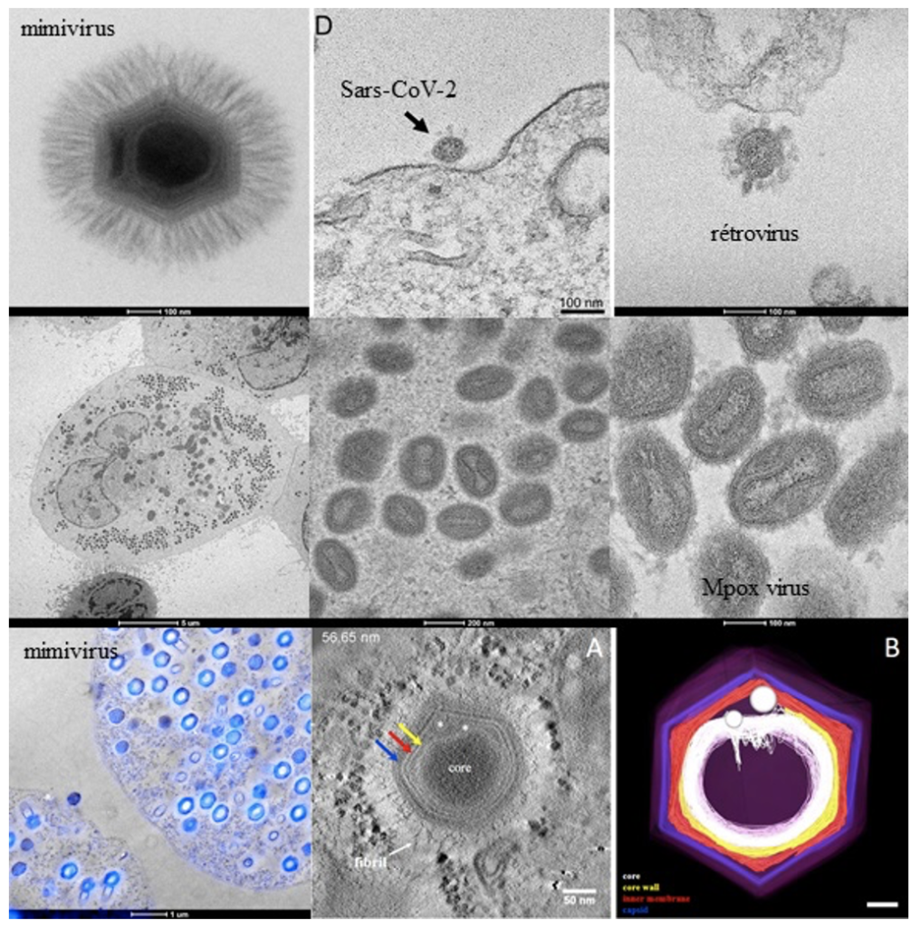 Microscopie Electronique a Transmission – IHU