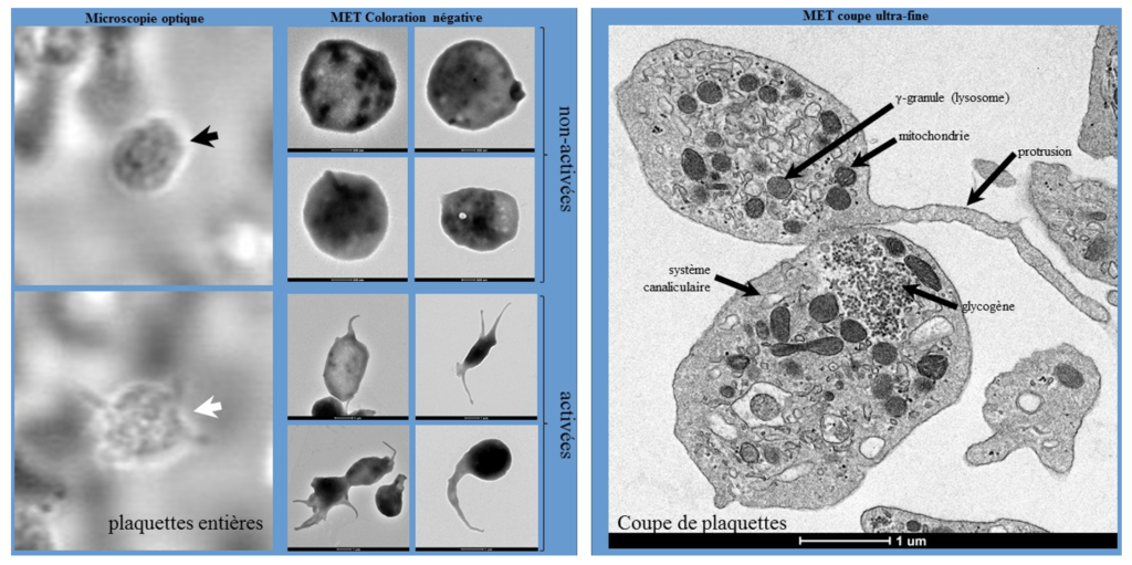 Microscopie Electronique a Transmission – IHU